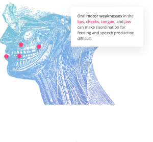 Feeding Therapy – Carlin Speech Pathology